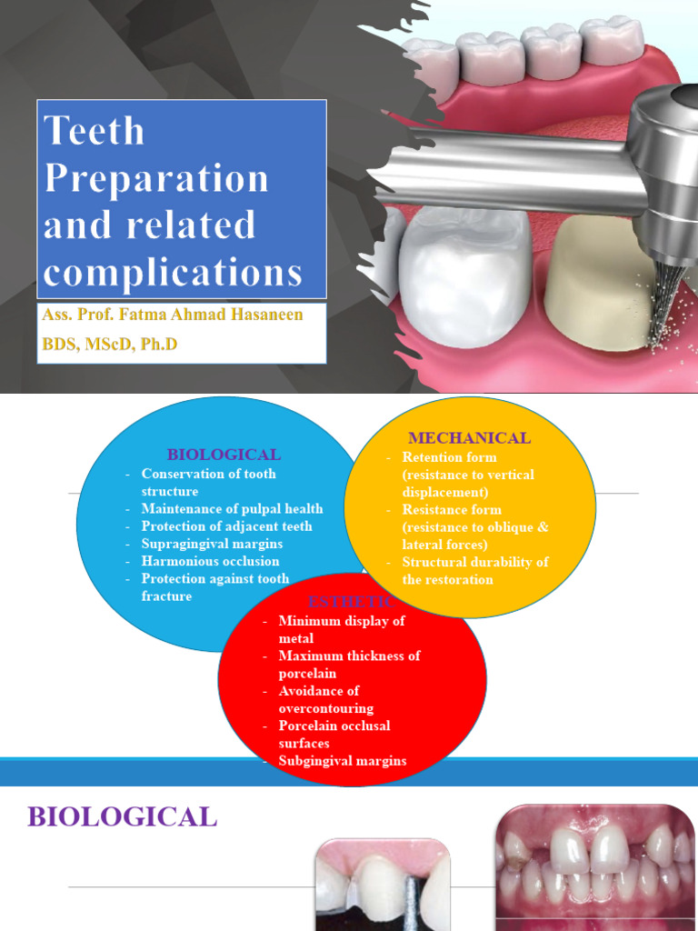 Teeth Preparation and Related Complications - 250413 - 065513 | PDF ...