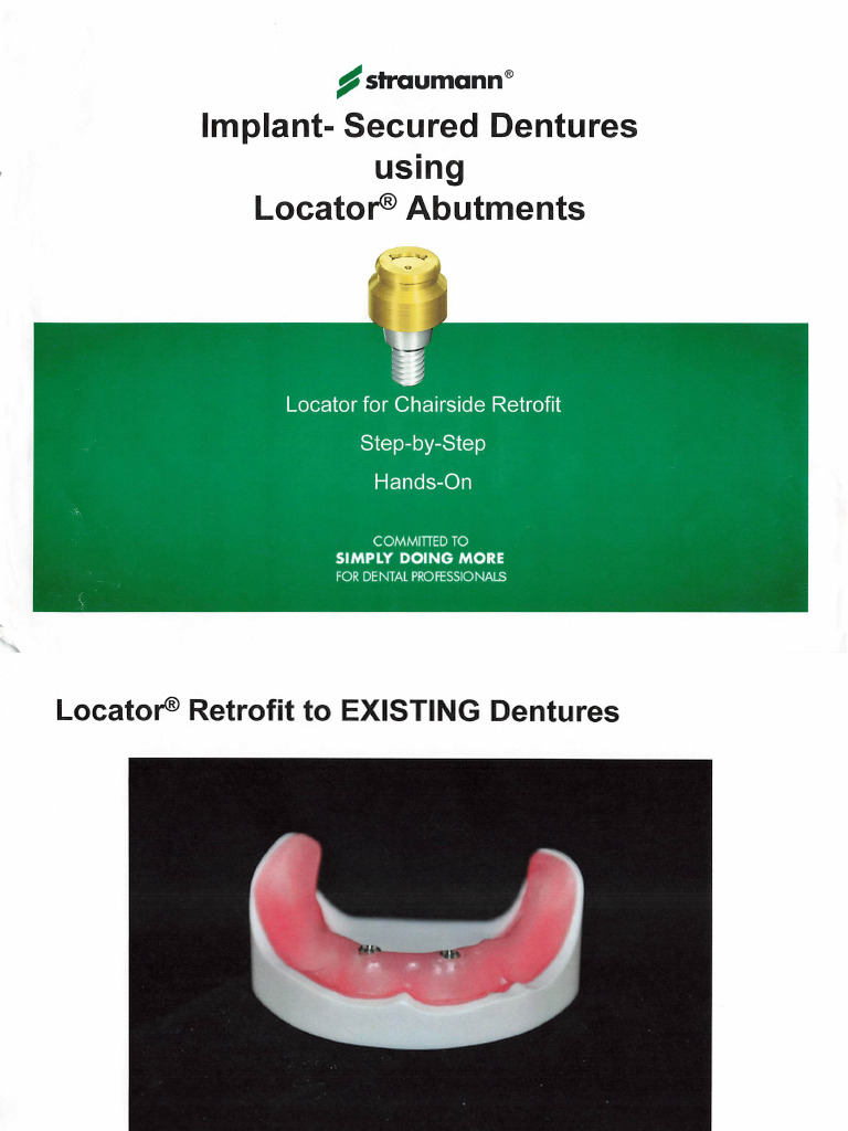 Straumann Implant - Secured Dentures Using Locator® A | PDF