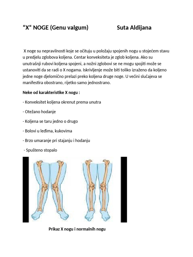 X Noge | PDF