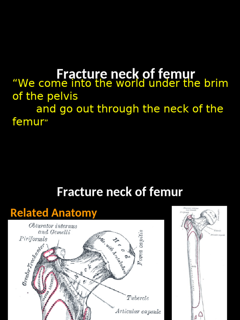 Fracture Neck and Intertrochanter Femur - Copy | PDF | Hip | Surgical ...