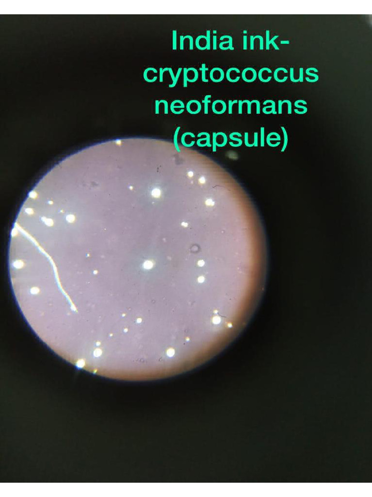 Microbiology spots | PDF