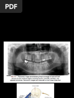 Panoramic Radiograph Interpretation Guide | PDF | Dental Anatomy ...