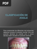 Clasificación Angle | PDF | Ortodoncia | Odontología