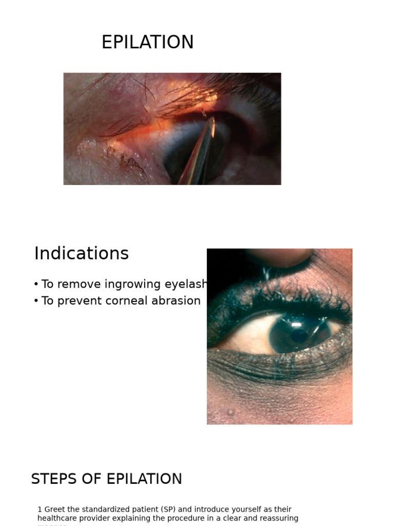 Epilation | PDF