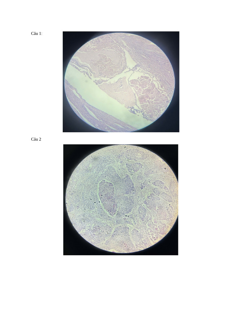 đề thi thử GPB 1 | PDF