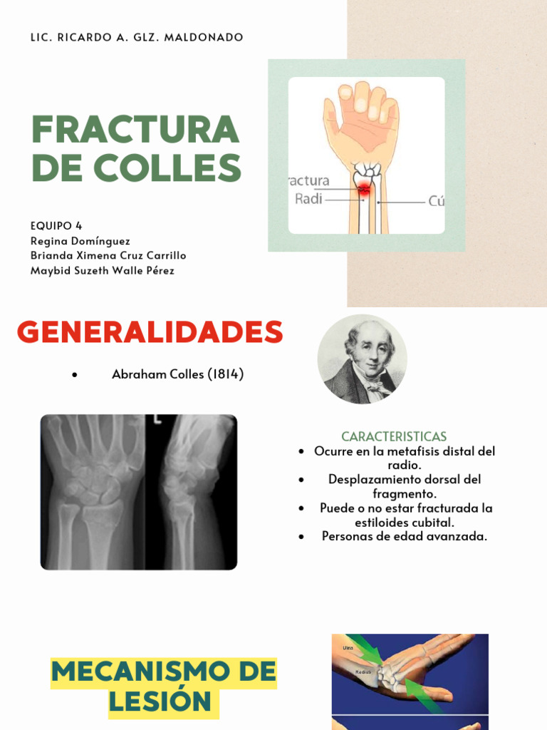 Fractura de Colles PDF | PDF | Sistema musculoesquelético