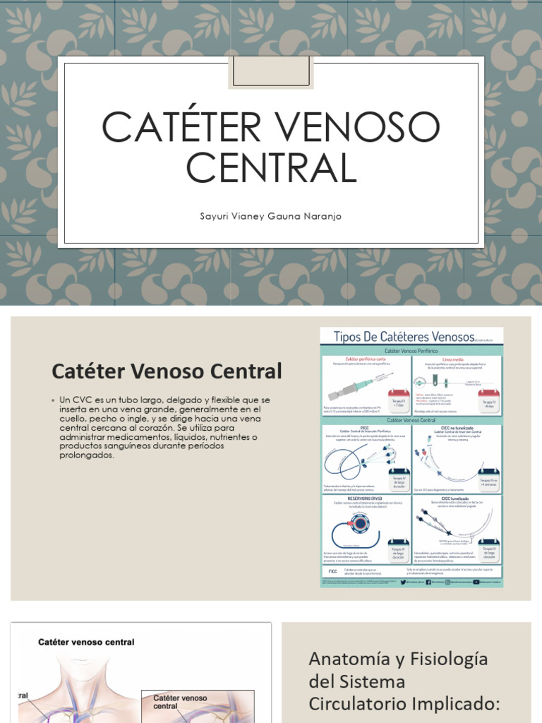 Catéter Venoso Central: Guía Completa | PDF | Vena | Sistema circulatorio