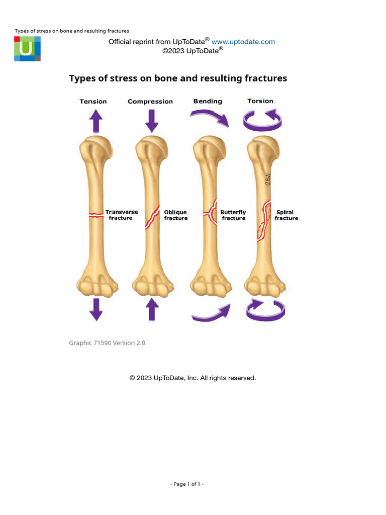 Types of Stress On Bone and Resulting Fractures | PDF