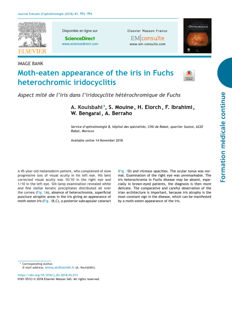 Moth-Eaten Iris in Fuchs Heterochromia | PDF