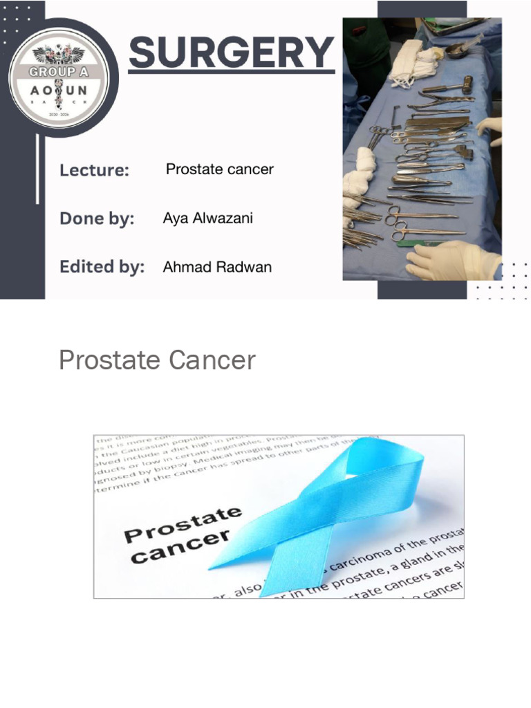 Lec 45-P2 - Prostate Cancer | PDF | Prostate Specific Antigen | Prostate Cancer
