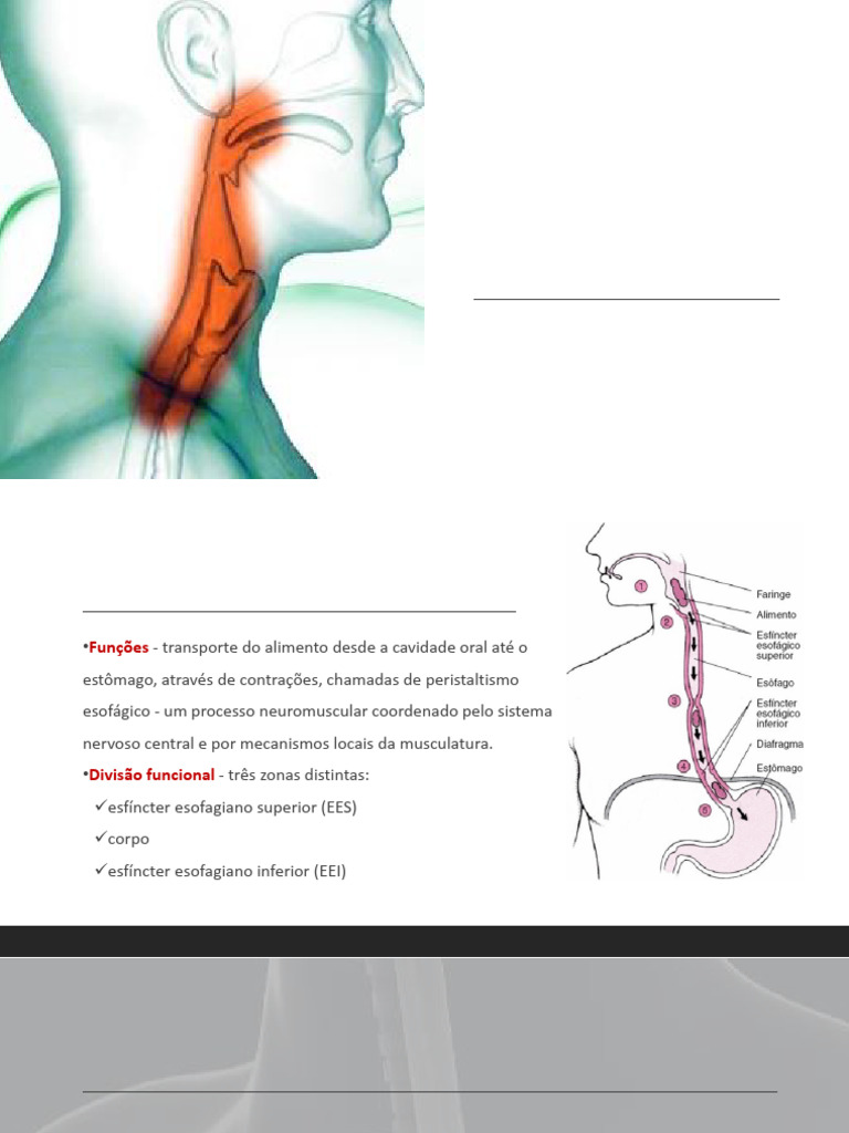 Terapia Nutricional Na Disfagia e Doenças Do Esôfago. | PDF | Esôfago ...
