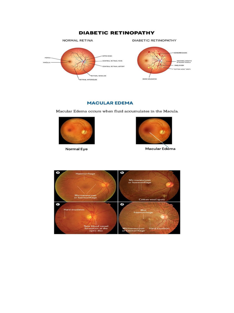 Fundus Images | PDF
