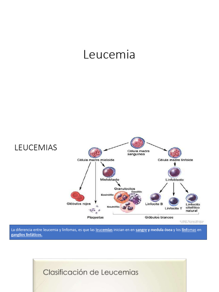Leucemia | PDF | Leucemia | Genética