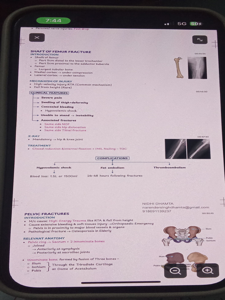 Pelvic Fracture | PDF