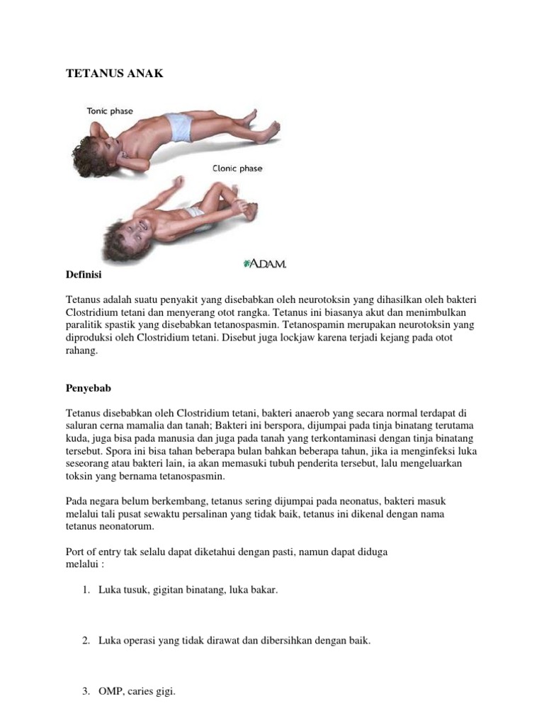 MENGURAI MISTERI PENYAKIT TETANUS PADA ANAK | PDF
