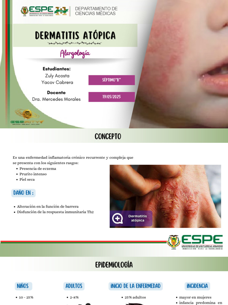 Tratamiento y diagnóstico de dermatitis atópica | PDF | Condiciones ...