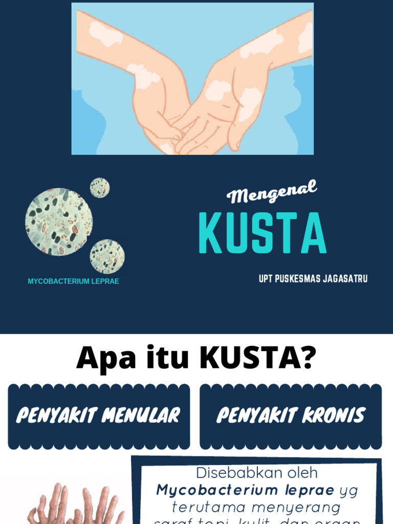 Lembar Balik Kusta | PDF