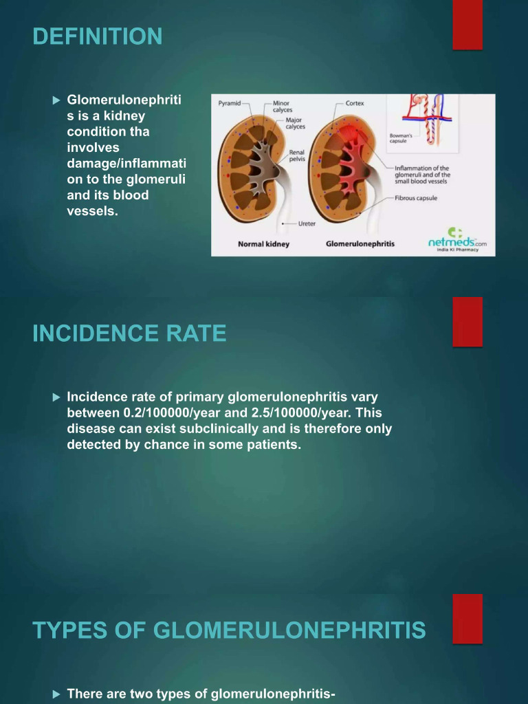 Acute Glomerulonephritis | PDF