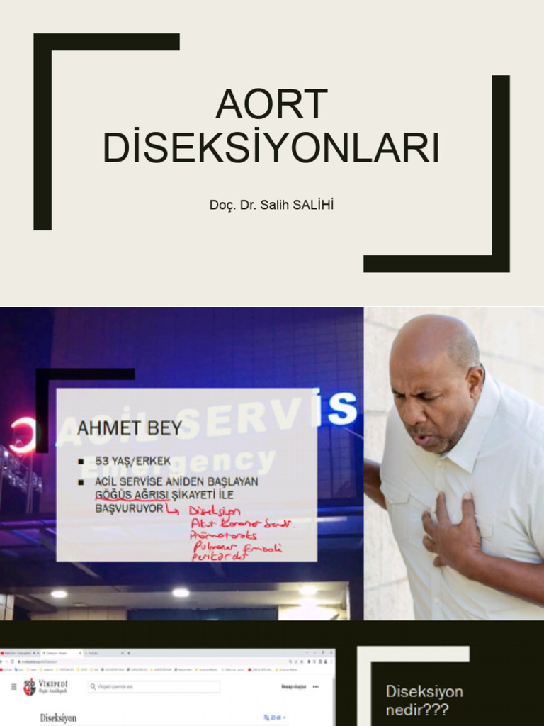 4) Aort Diseksiyonları-S Salihi | PDF