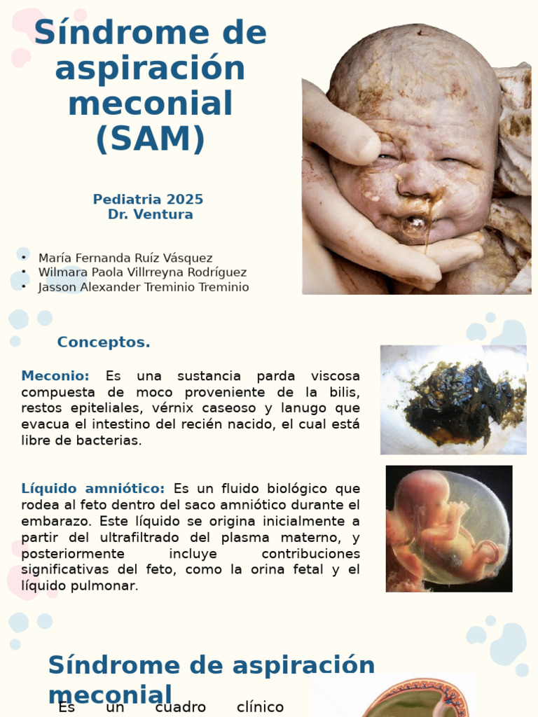 Síndrome de Aspiración Meconial en Neonatos | PDF | Feto | Enfermedades ...