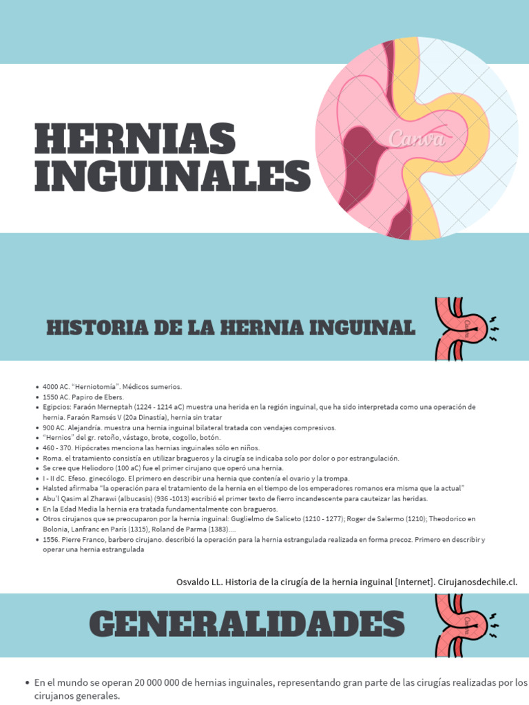 Hernias Inguinales Presentación | PDF