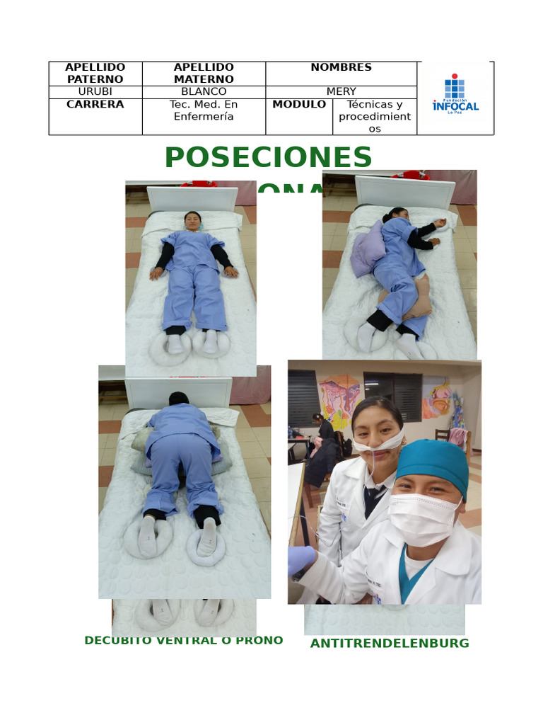 Posiciones Fowler Mery | PDF