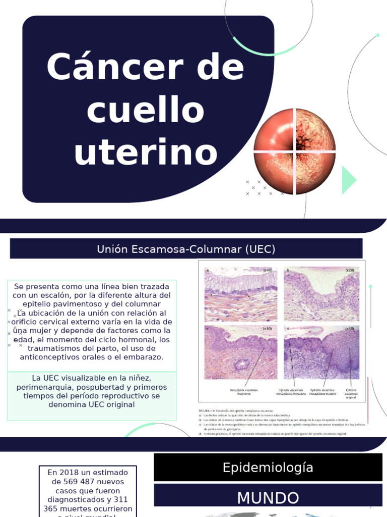 Cancer de Cuello Uterino | PDF | Cáncer de cuello uterino | Cáncer