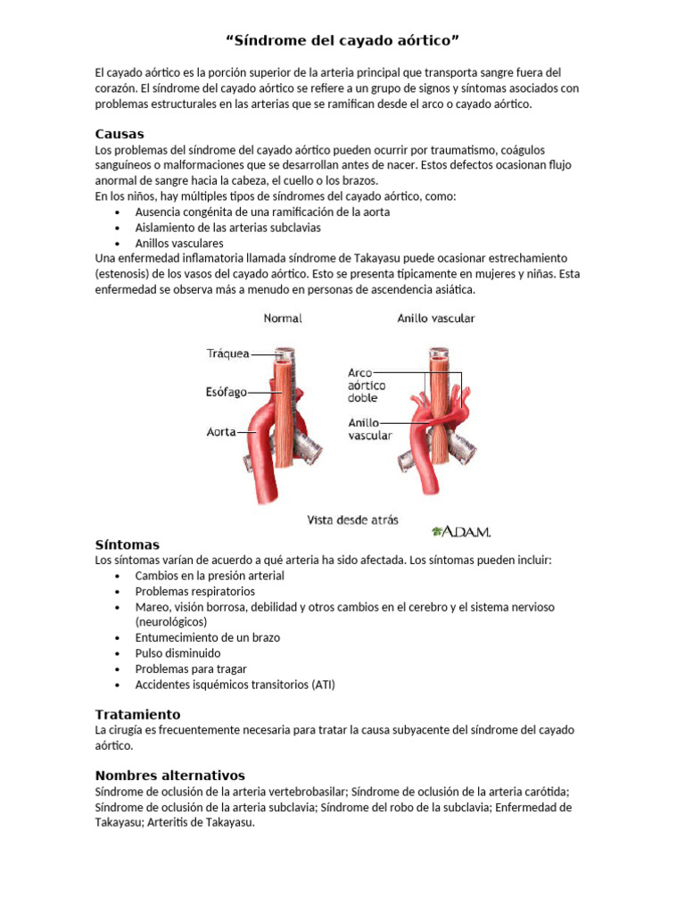 Síndrome Del Cayado Aórtico | PDF