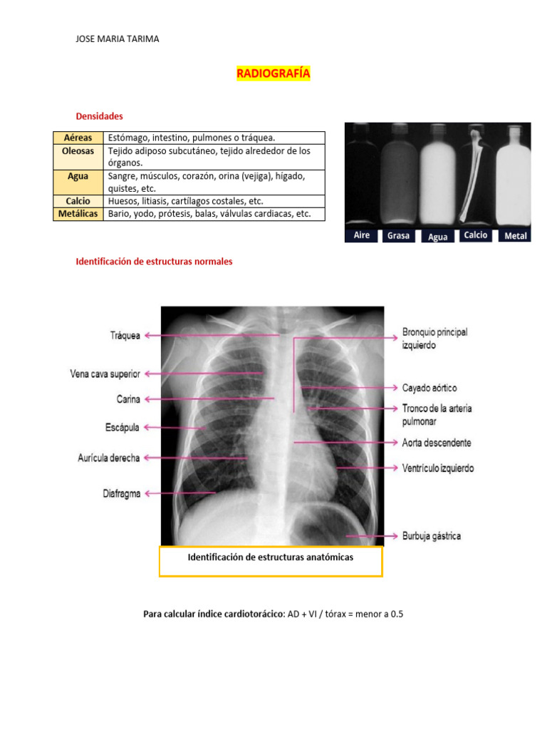 Radiografía: Análisis de Trama Hiliar | PDF | Tórax | Pulmón