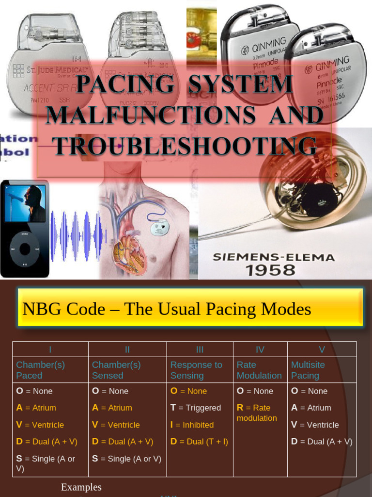 Pacing System Malfunctions Seminar | PDF | Artificial Cardiac Pacemaker ...
