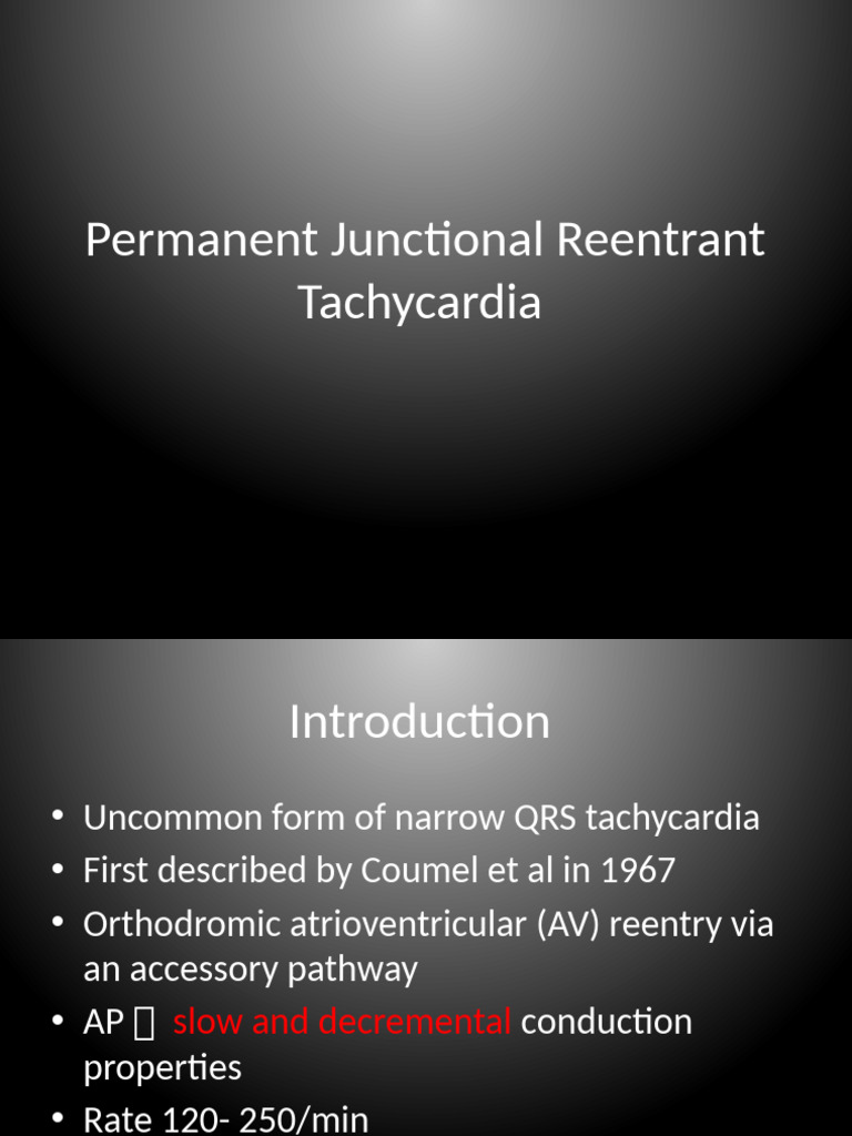 Permanent Junctional Reentrant Tachycardia | PDF | Diseases And Disorders | Electrophysiology