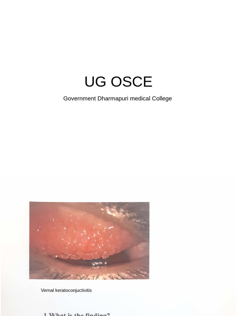 Osce Ophthalmology UG | PDF