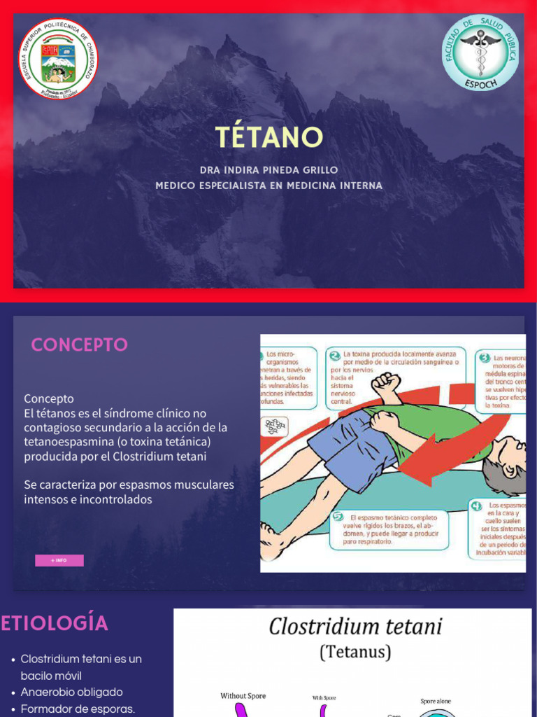 Tétano: Síntomas y Tratamiento | PDF | Especialidades Medicas