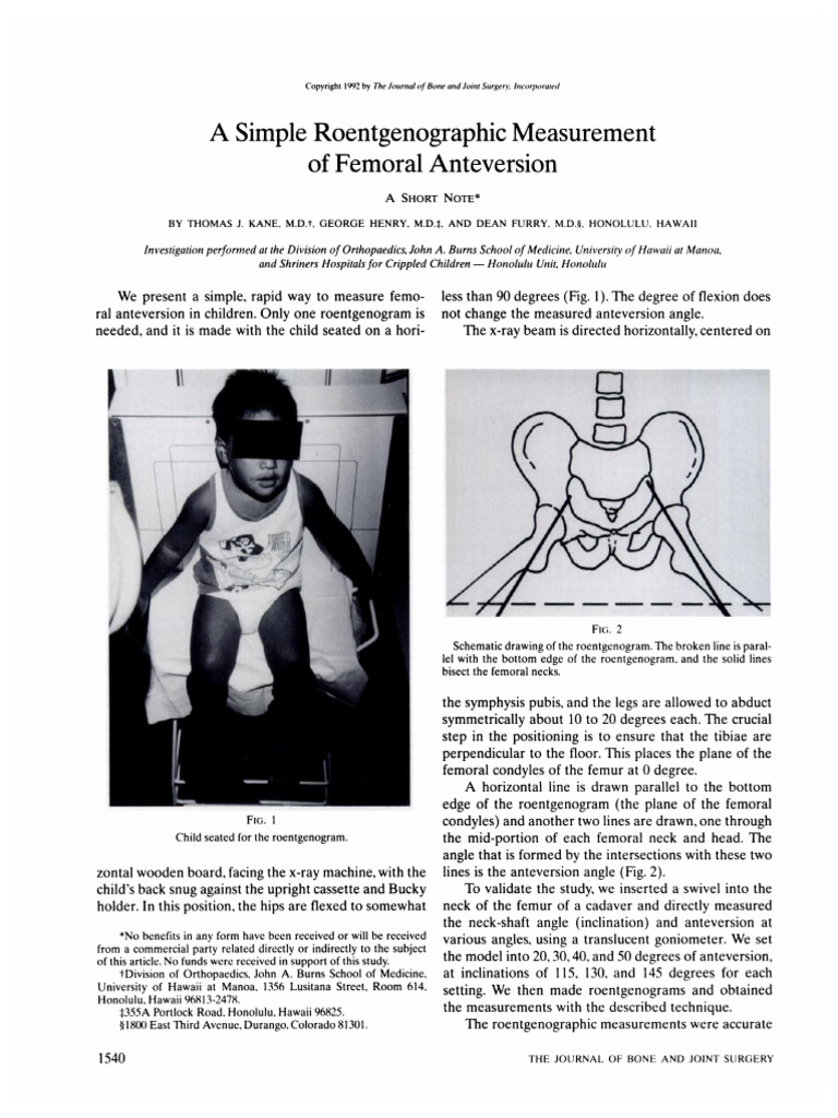 A Simple Roentgenographic Measurement of Femoral Anteversion | PDF ...
