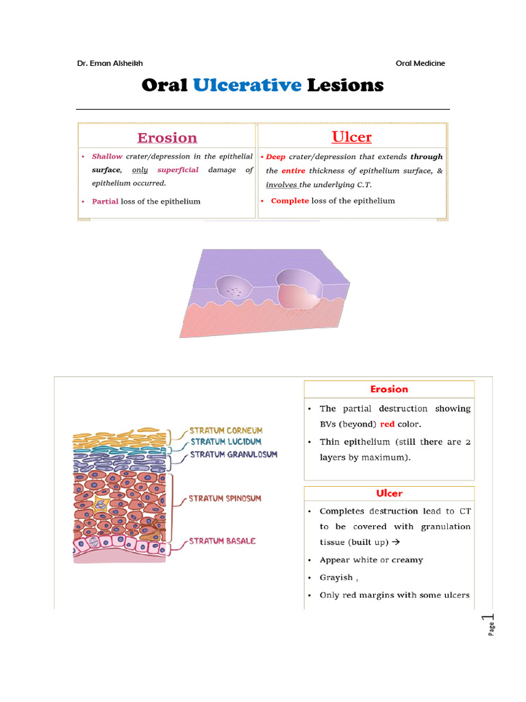 Oral Ulcerative Lesions Overview | PDF | Medicine | Diseases And Disorders