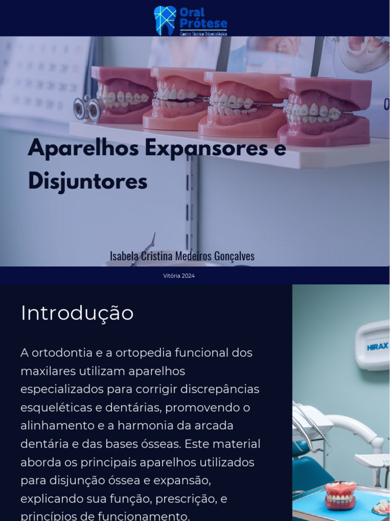 Aparelhos Expansores na Ortodontia | PDF | Ortodontia | Dente humano