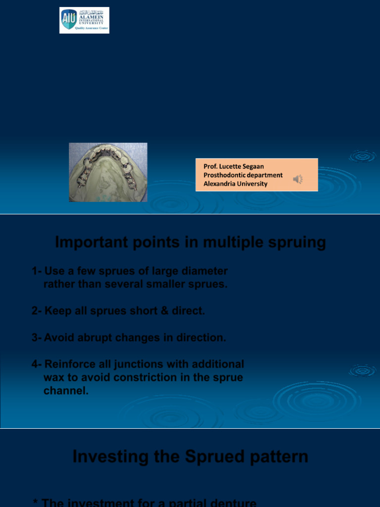 RPD Framework Construction Procedures | PDF | Casting | Dentures