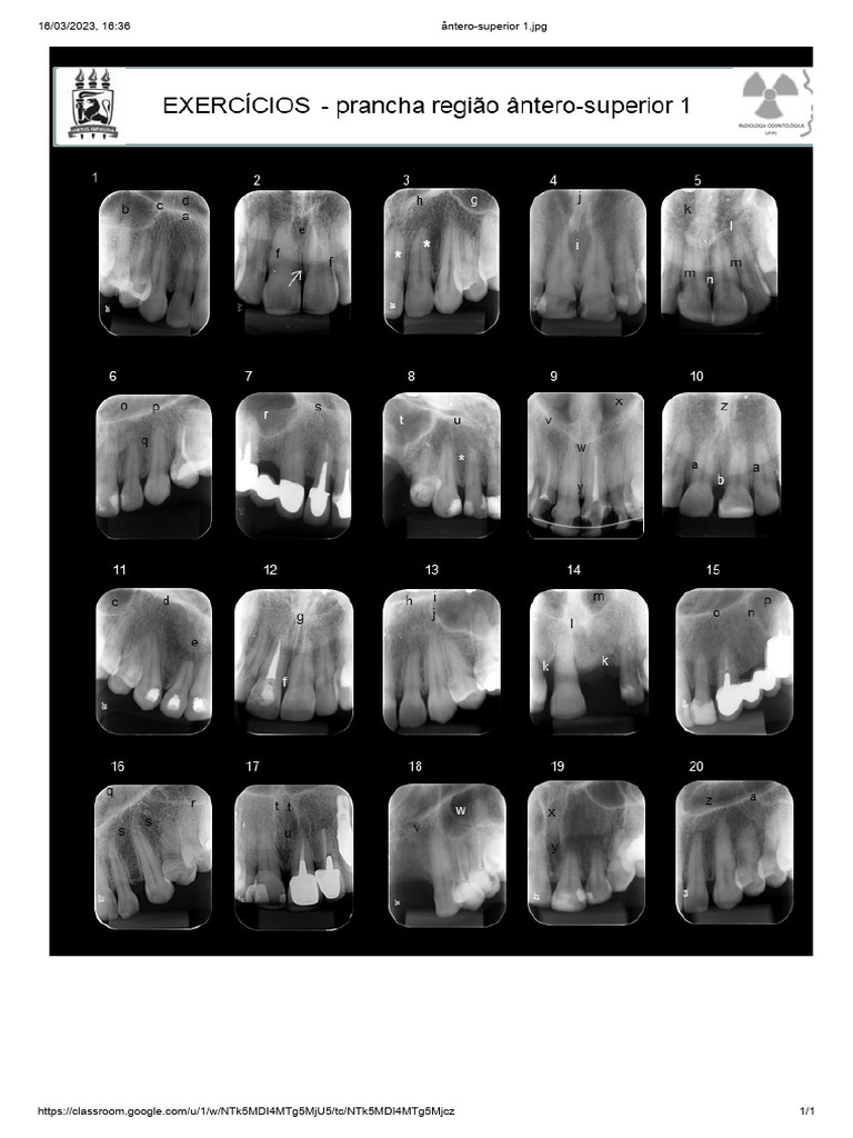 Prancha Ntero-Superior 1 2 | PDF
