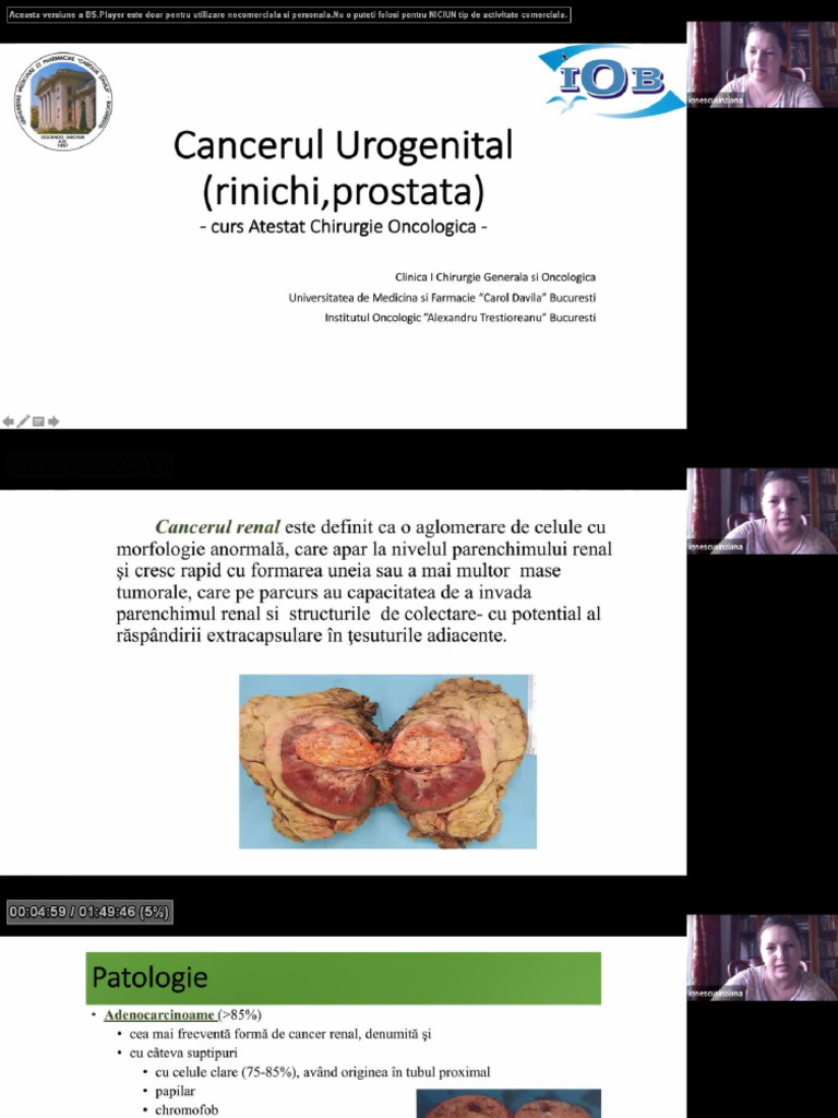 Cancerul Urogenital | PDF