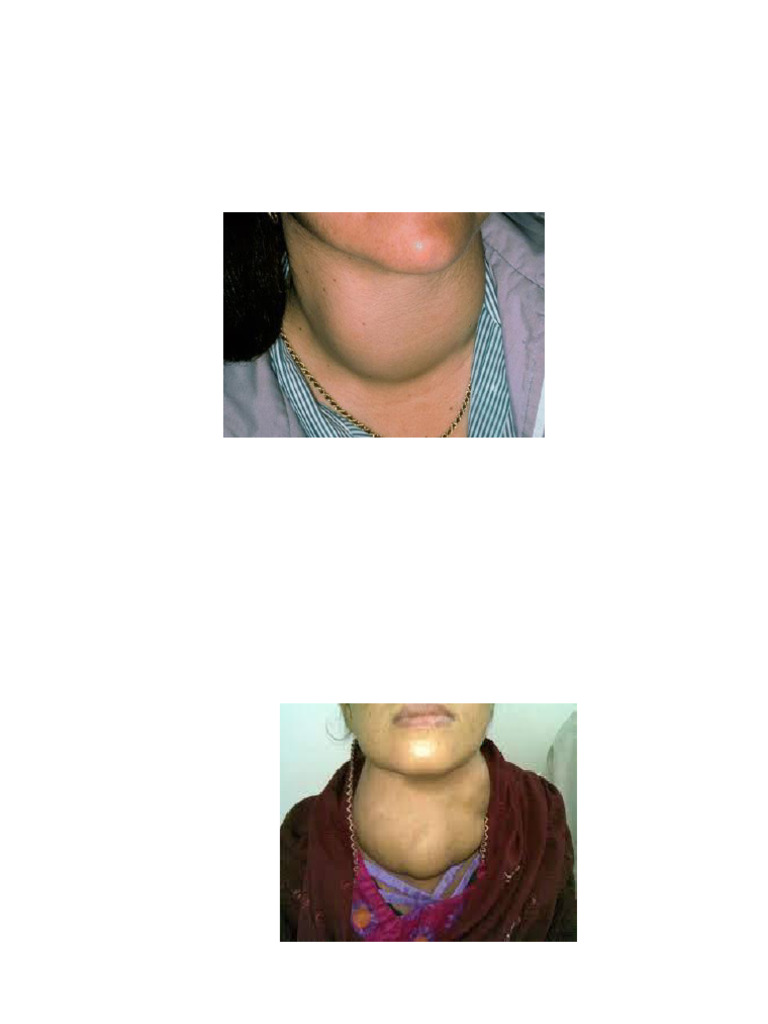 Thyroid and Calcium Investigation 1 | PDF