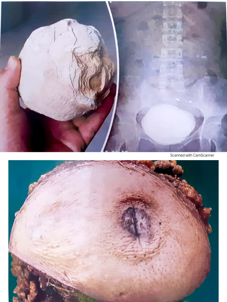 Xray, Specimen, Operative Surgery | PDF