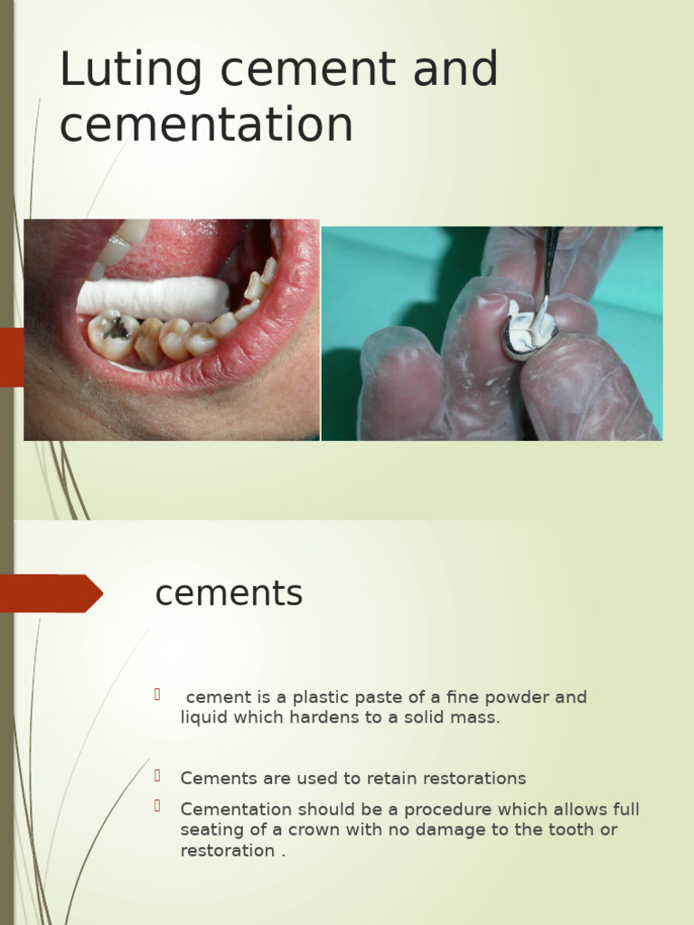 10-Luting Cement and Cementation Techniqes - Nile | PDF | Dental ...