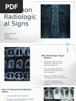 Hilum Overlay Sign in Chest Imaging | PDF