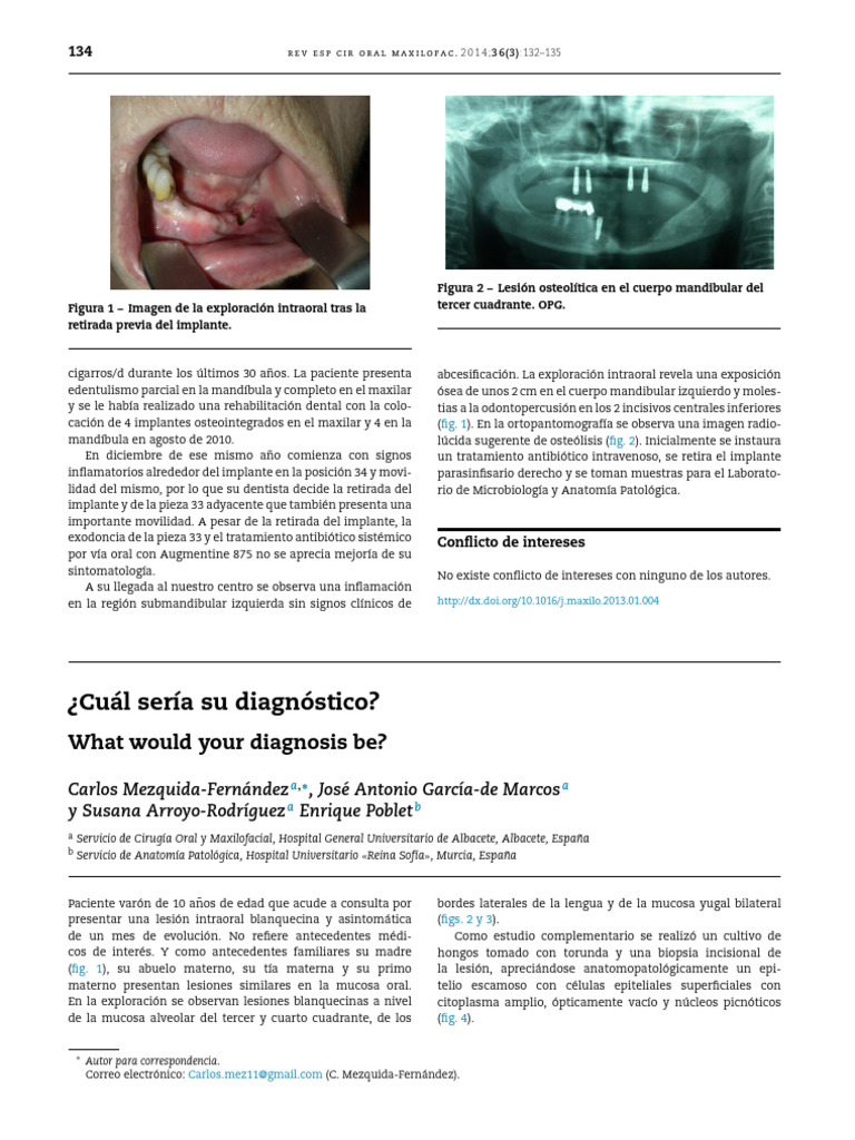 Cu L Ser A Su Diagn Stico 2014 Revista Espa Ola de Cirug A Oral y Maxilofac | PDF | Enfermedades ...