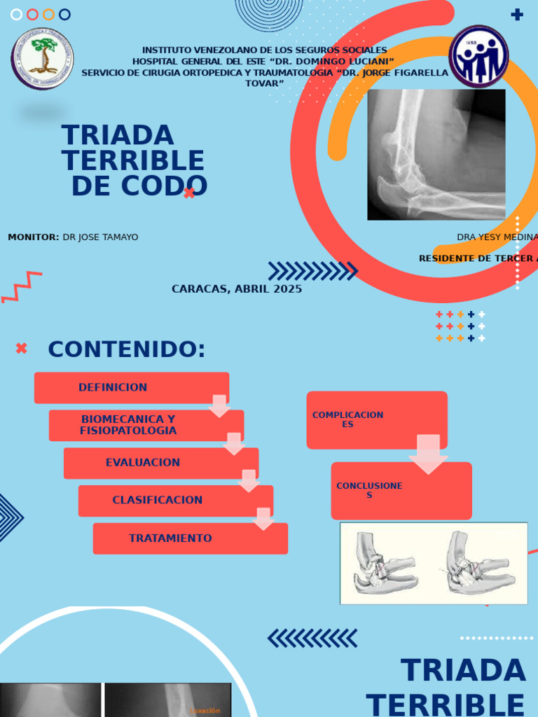 Terrible Triad Injury of Elbow YM | PDF | Codo | Extremidades (anatomía)
