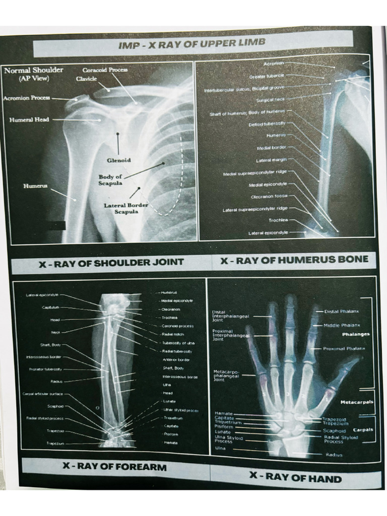 Bones Chart Johari | PDF