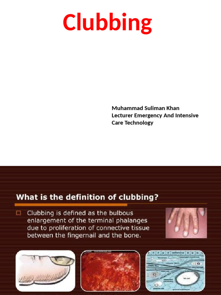 Clubbing | PDF