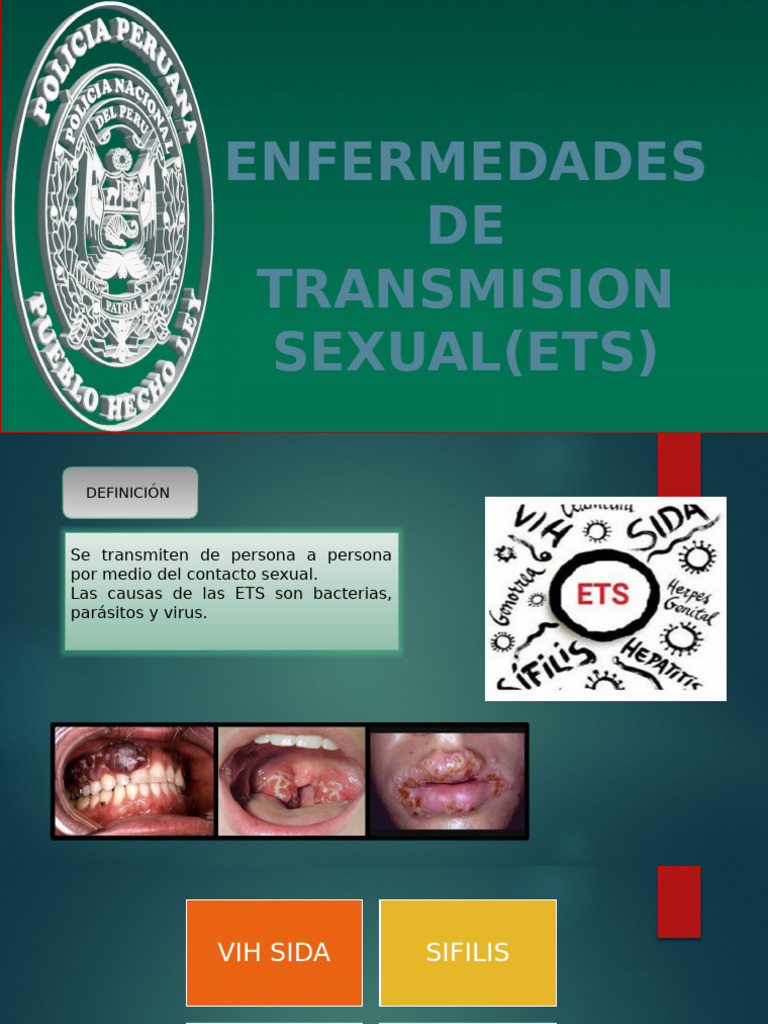 Enfermedades DE Transmision Sexual (Ets) | PDF