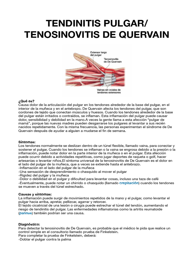 Tendinitis de De Quervain en el pulgar | PDF | Tendón | Mano
