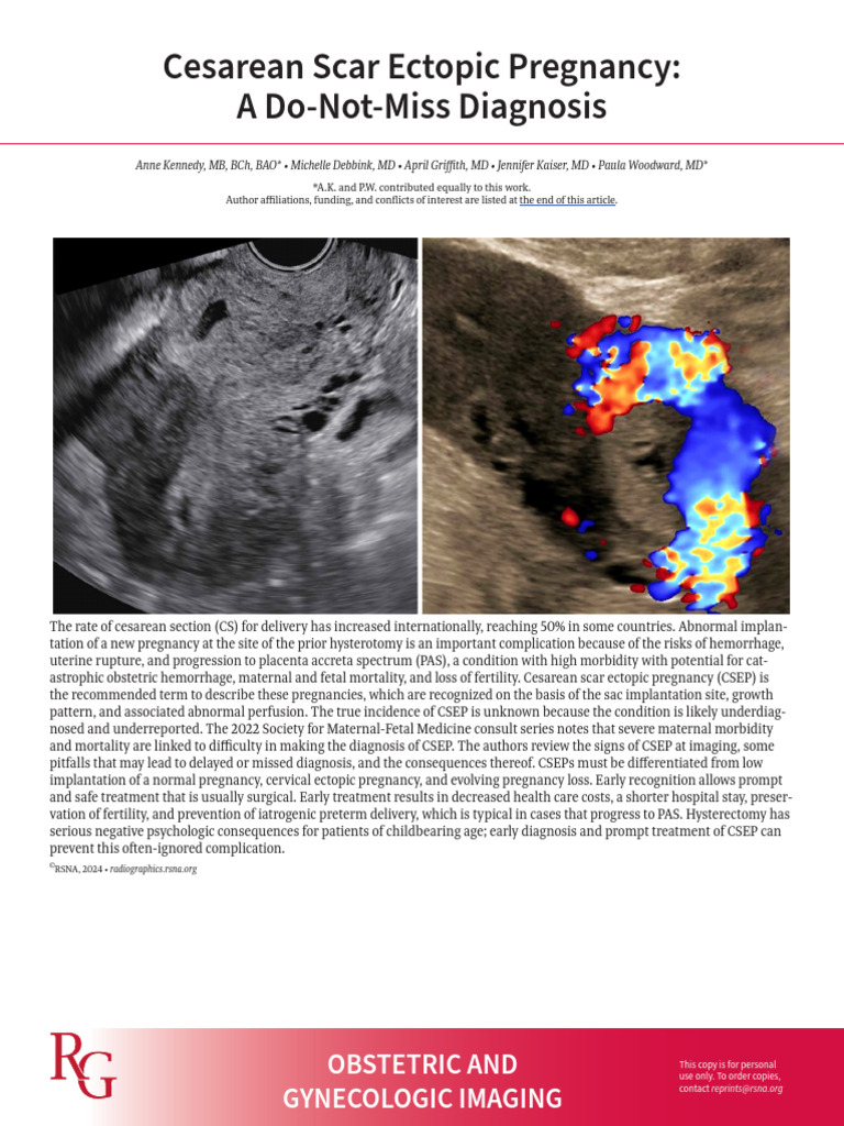 Cesarean Scar Ectopic Pregnancy Insights | PDF | Uterus | Caesarean Section